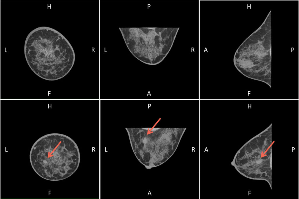 nu:view 设备介绍- AB-CT – Advanced Breast-CT